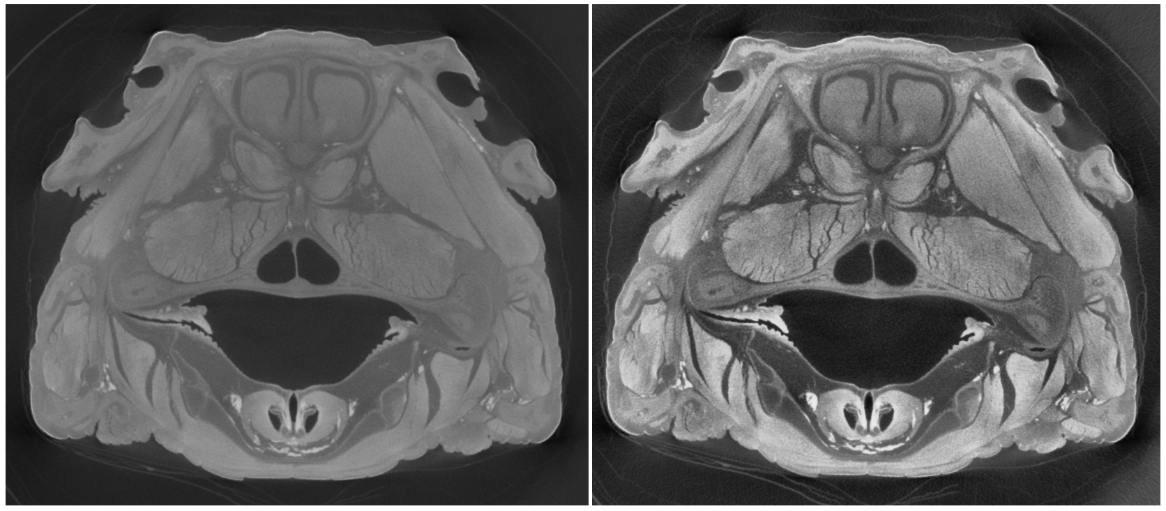 Get Your Brights Brighter & Darks Darker: CLAHE + diceCT – DiceCT