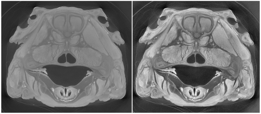 Get Your Brights Brighter & Darks Darker: CLAHE + diceCT – DiceCT